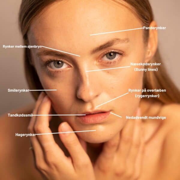 Filler behandling af rynker | Book tid i dag > Priser fra 1.800,-